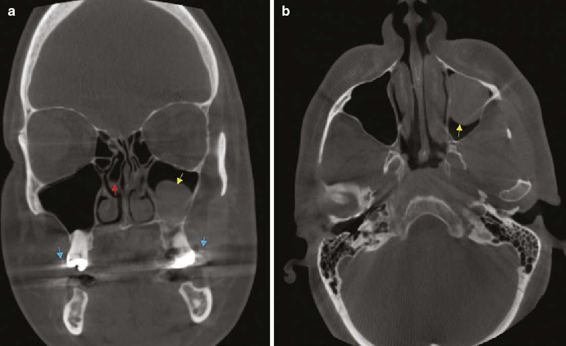 Craniofacial Imaging - Directory Datacaptive